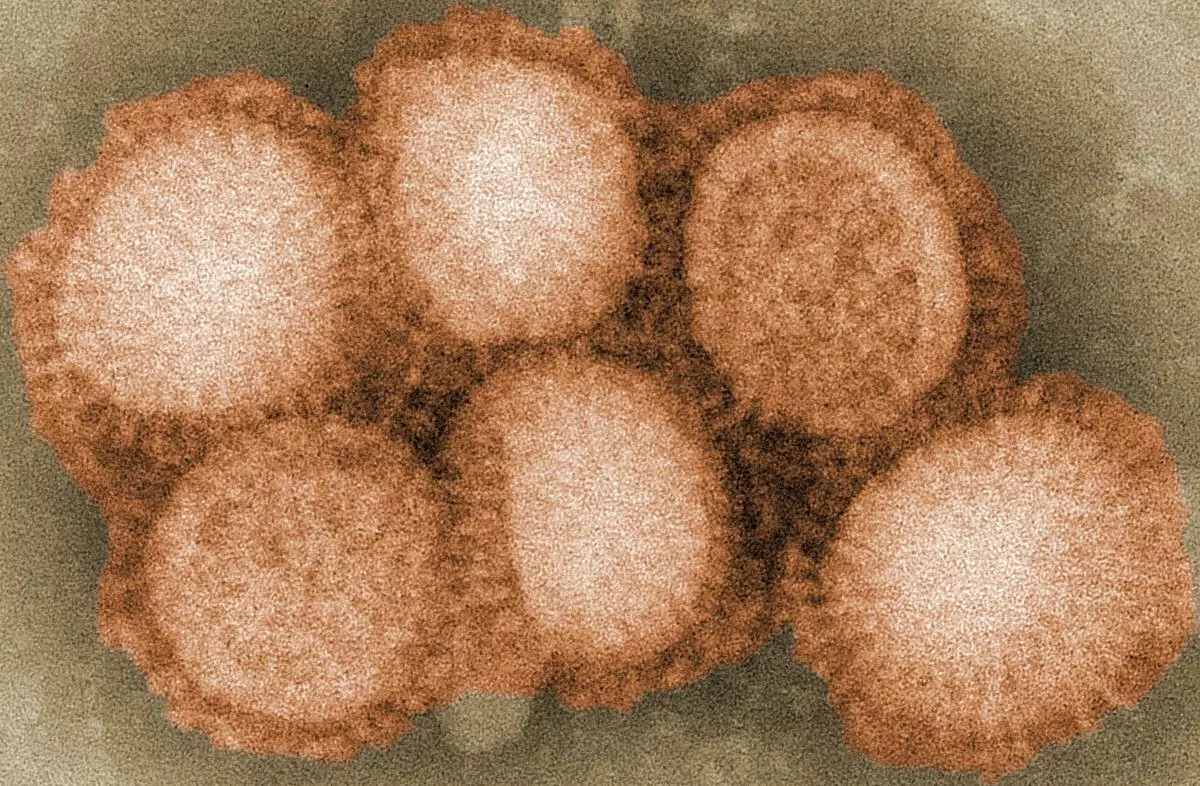 I Russland, verdens første tilfeller av infeksjon av fugleinfluensa H5N8