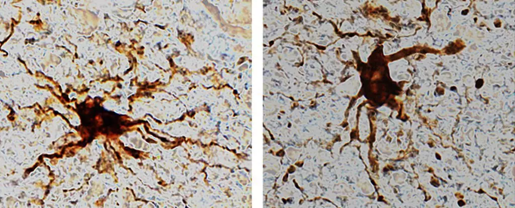 En el cerebro humano descubierto células "zombie", el aumento de la actividad después de la muerte