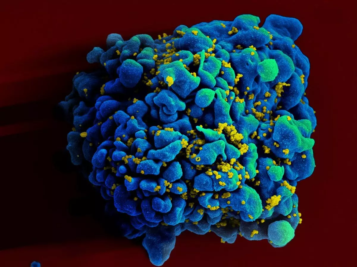 HIV is no longer fatal