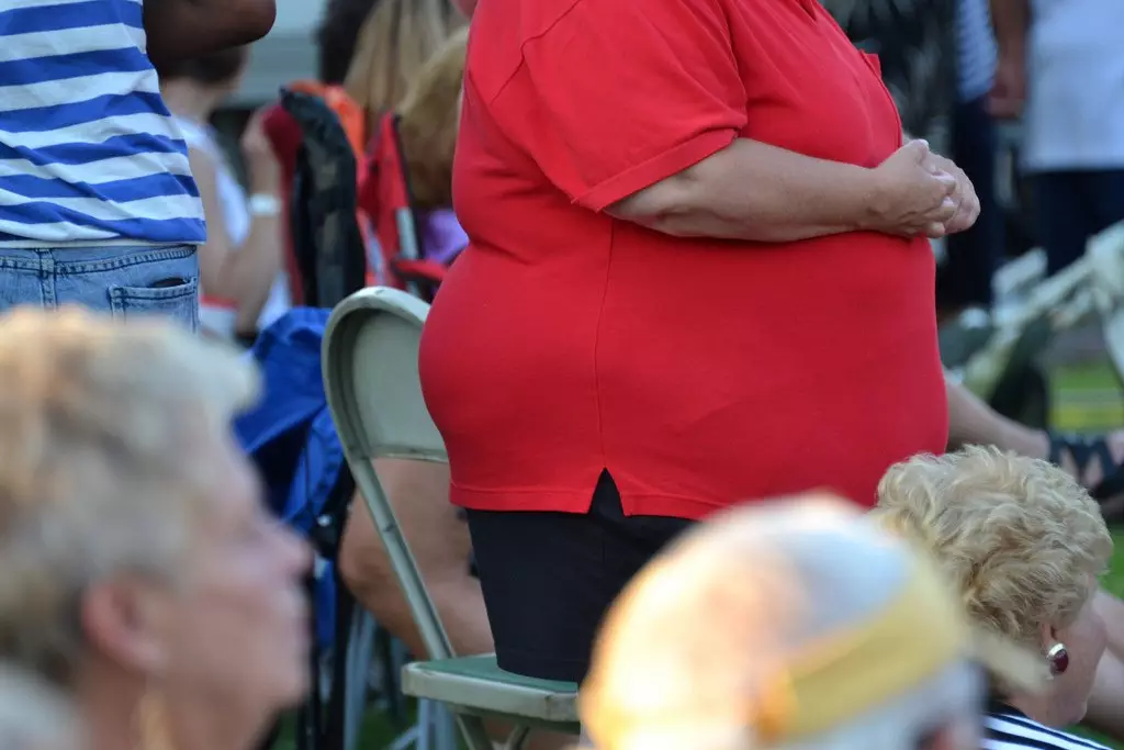 El número de rusos con obesidad aumenta.