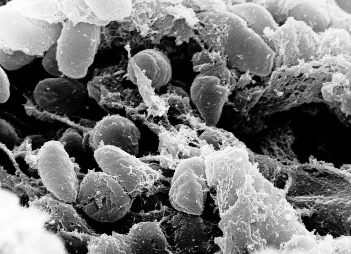 Yersinia Pestis