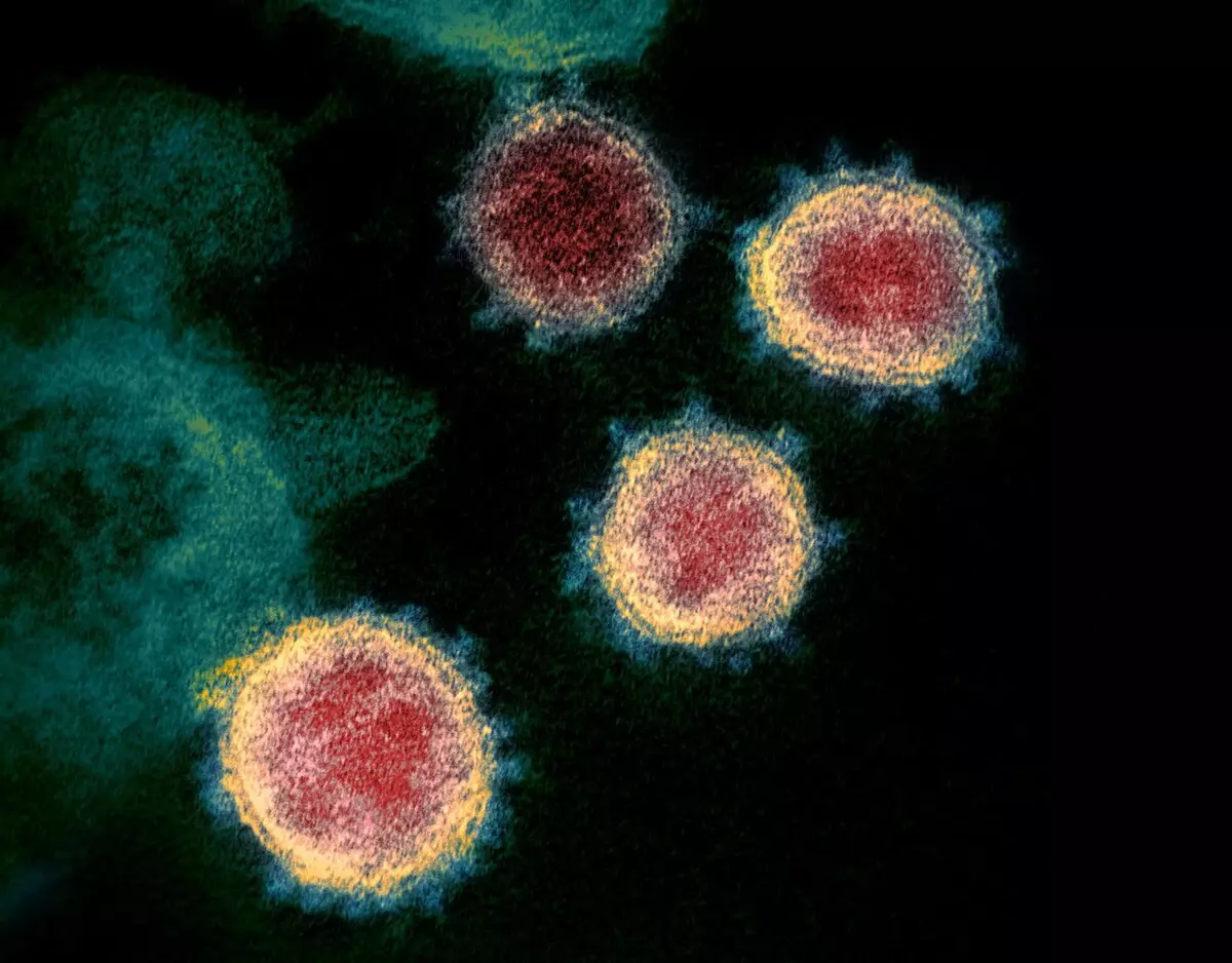Naiid: Coronavirus.jpg.