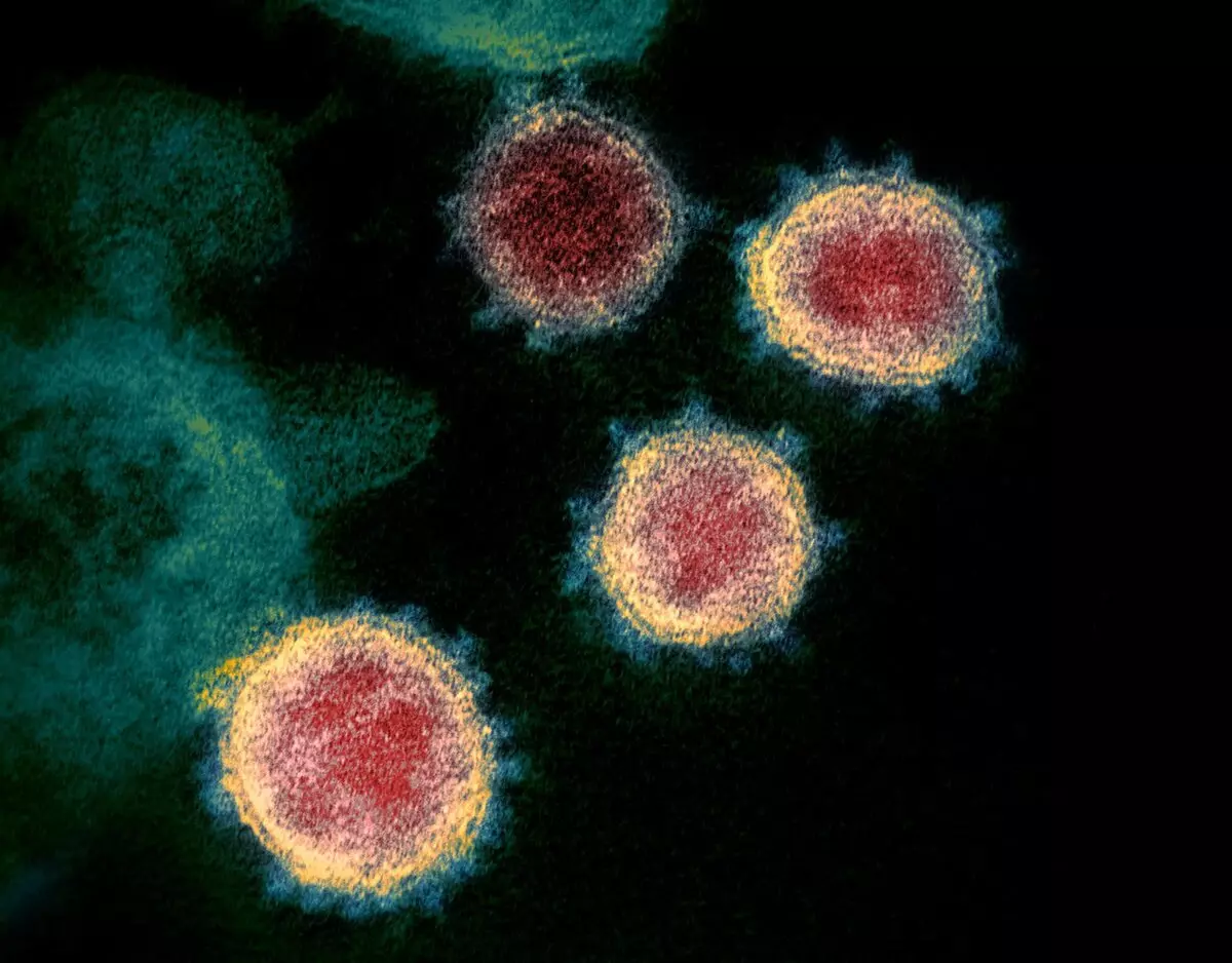 NIAID: coronavirus.jpg.