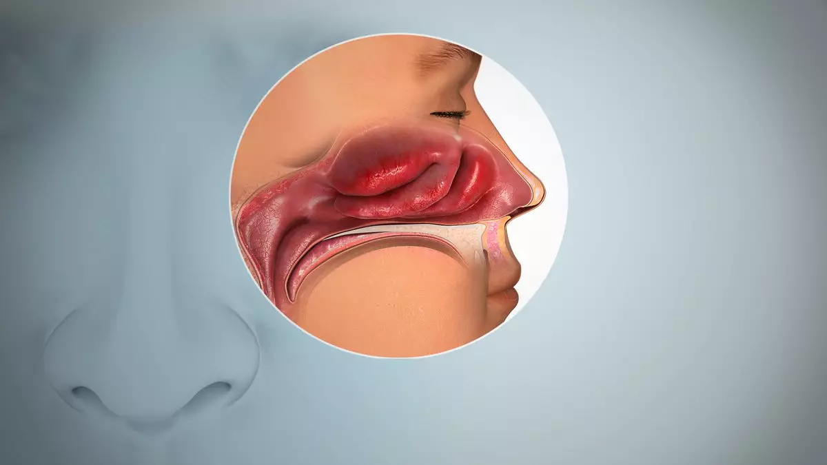 Zašto pacijenti s COVID-19 ne osjećaju miris bez nazala