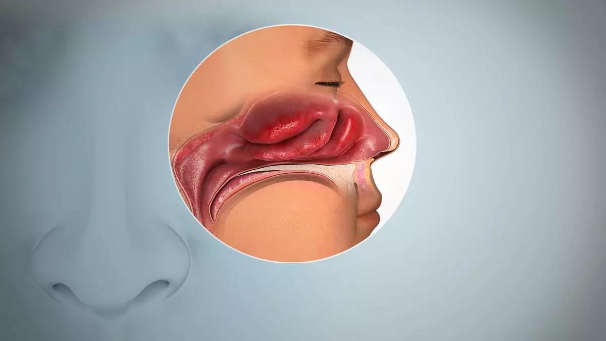 Why patients with COVID-19 do not feel smell without nasal