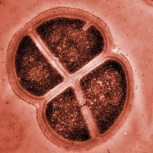 Deinococcus radiodurans.