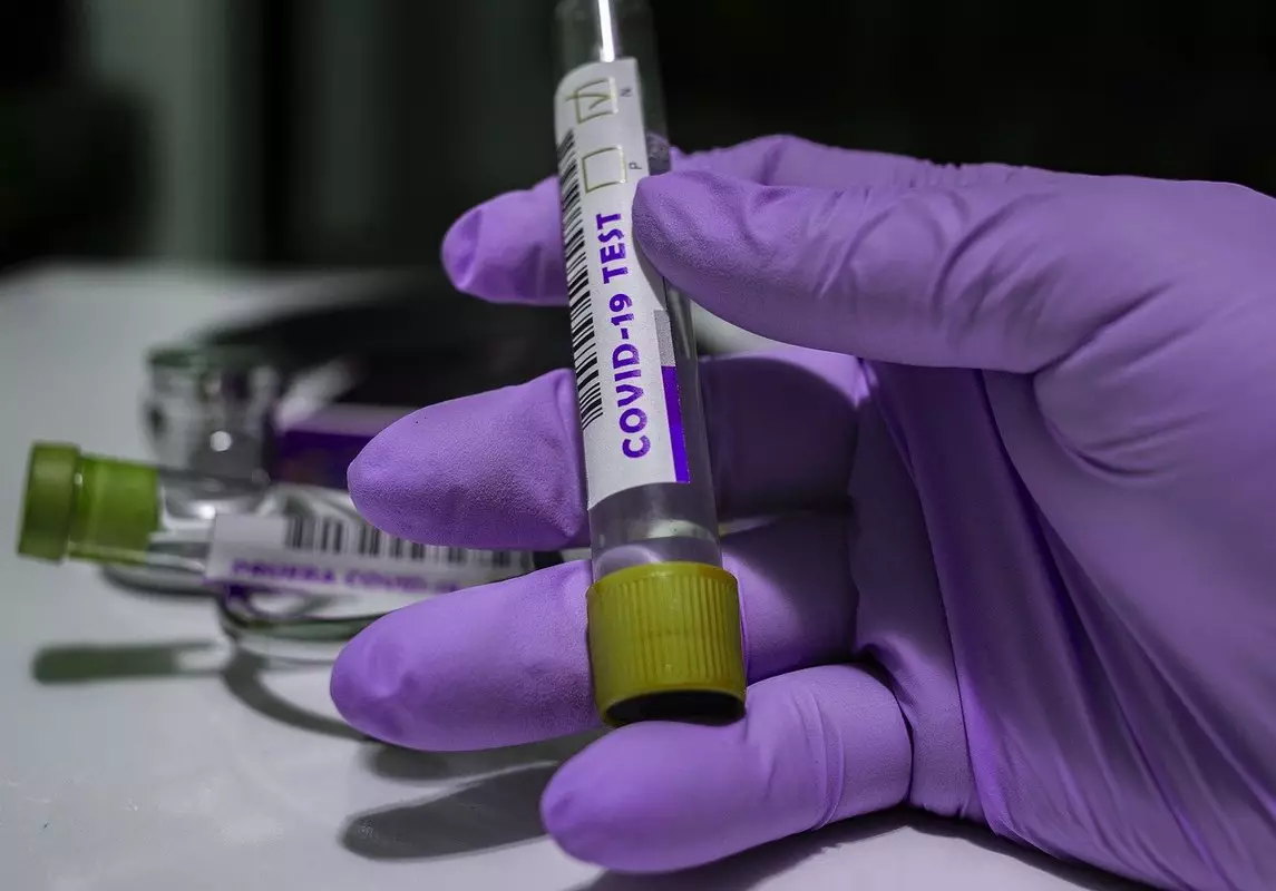 Amérika Serikat disatujuan heula dina inféksi ngahaja sareng CoronAvirus