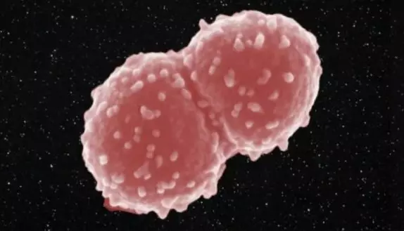 Bacterias-extremophil pasó un año en el espacio abierto. Y sobrevivió!