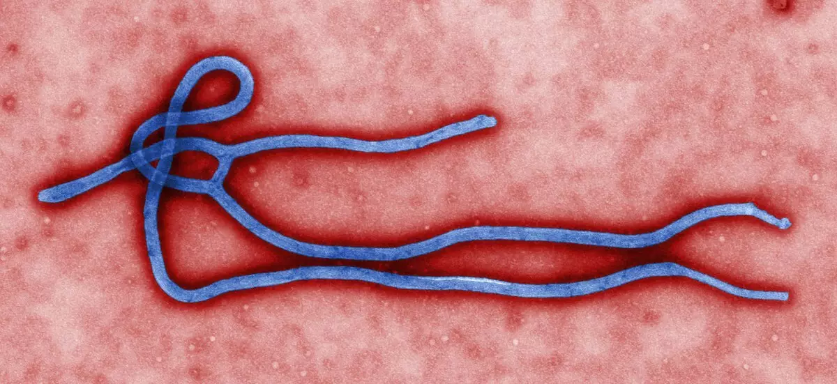 Urukingo rw'Uburusiya ruva muri Ebola: iyo igaragaye kandi ikabye
