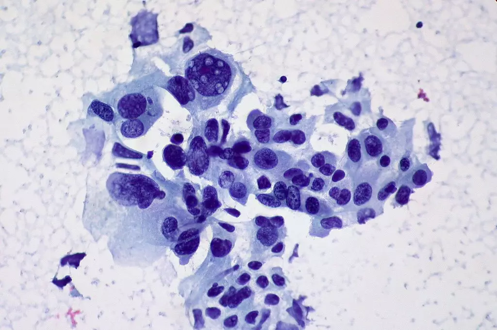 Cales son as células cancerosas difieren de saudable?