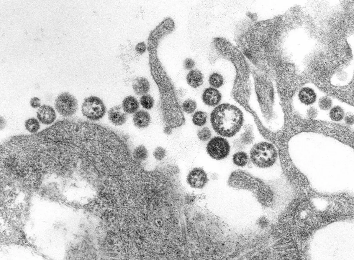 Negli Stati Uniti, una febbre pericolosa di Lassa è arrivata negli Stati Uniti