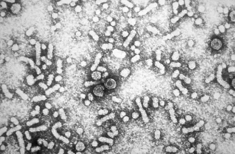 Вирус мыңдаған жылдар: гепатиттің ең үлкен іздерін тапты