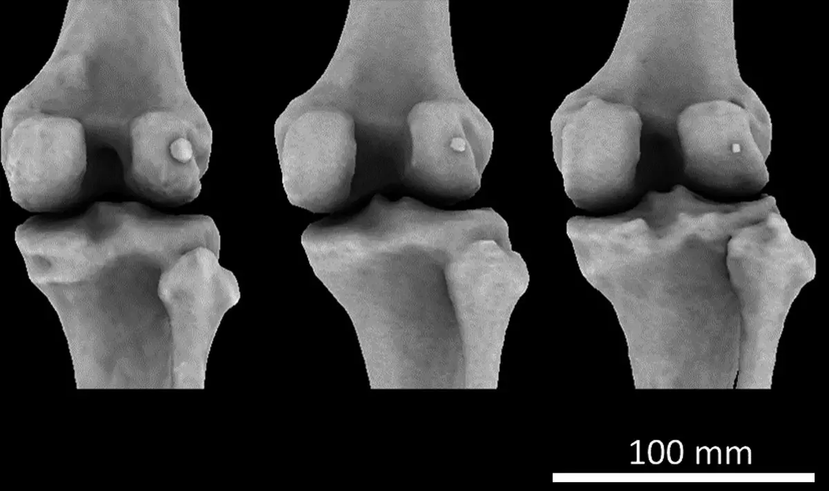 En la homa korpo trovis oston konsiderata perdita