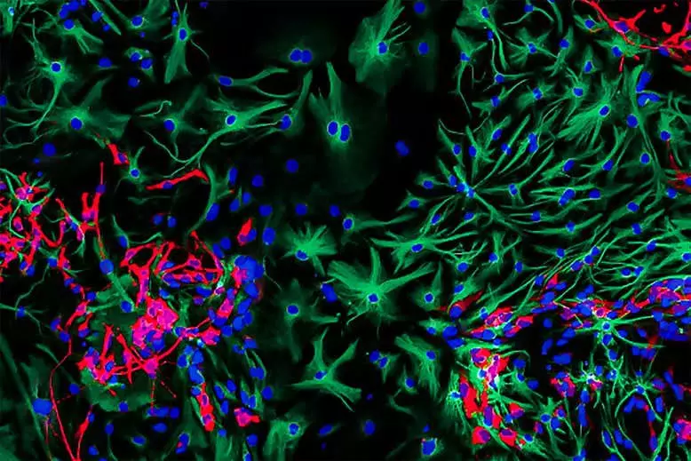 Alperes szépség: A rákos sejtek képe az orvosok fotóversenyében nyert