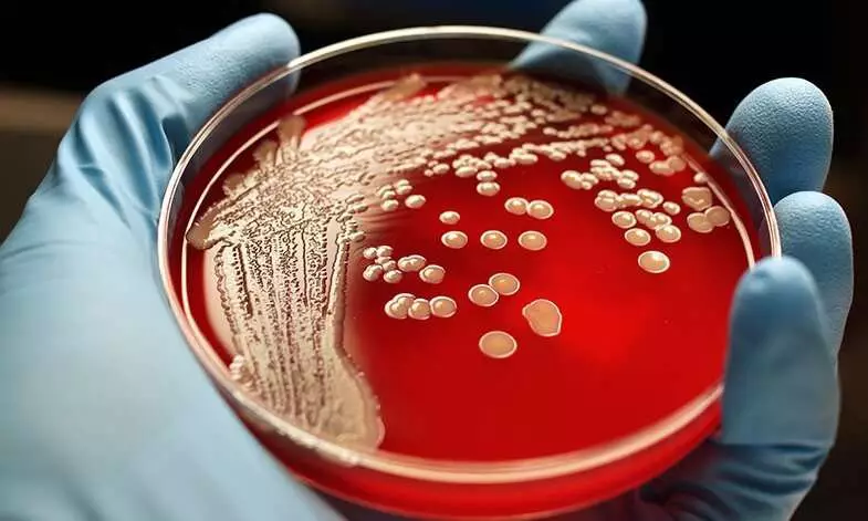 Uusi yhteys on kehitetty, joka tappaa superfakteerien kestäviä antibiootteja