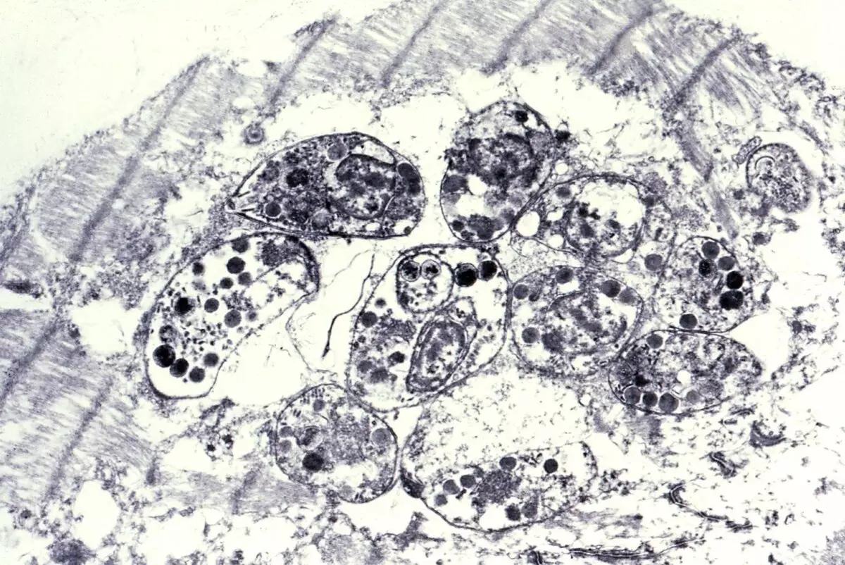 ဦး နှောက်ကင်ဆာနှင့်အတူချည်ထားသောကြောင်များမှလူမှကူးစက်သောကပ်ပါးကောင်