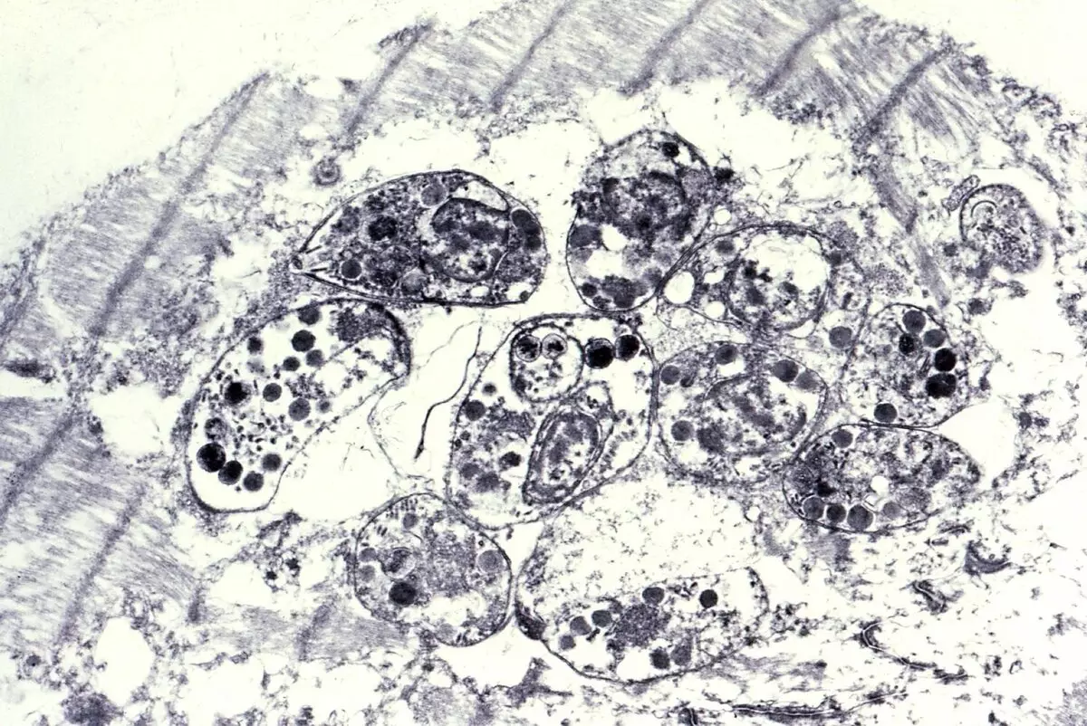 Toxoplasma Gondii.