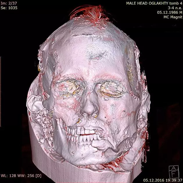 CT Skull Ancient Tashtyk