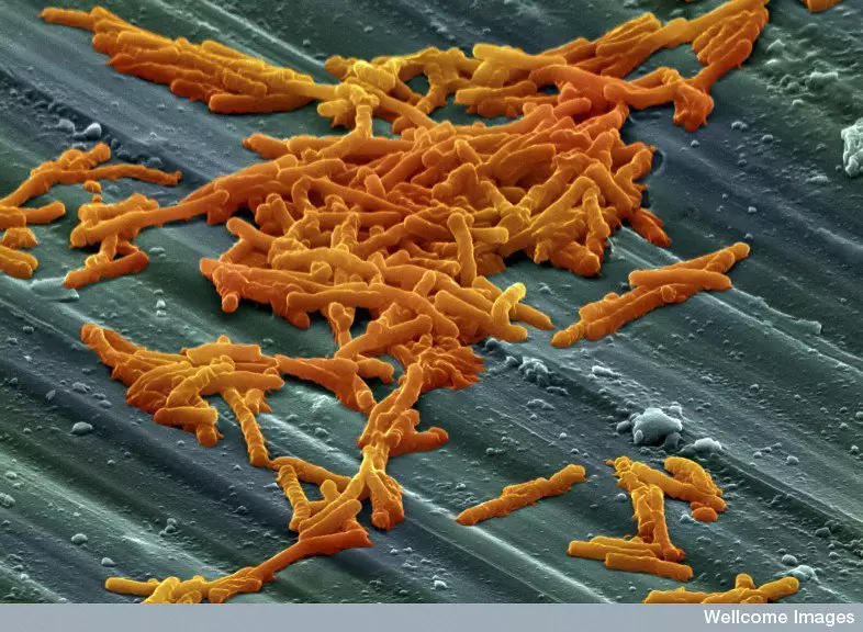 Ang superbacterium milambo ug mahimong mosangput sa usa ka epidemya