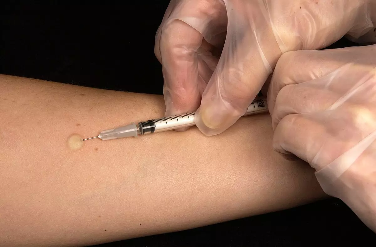 ઑસ્ટ્રેલિયામાં, અમે એક રસી વિકસાવી જે જીવન માટે ટ્યુબરક્યુલોસિસથી બચાવશે