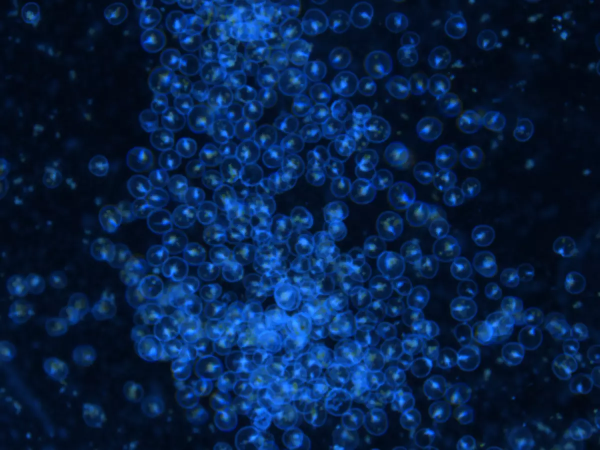 آبی اشک - rns-under-microscope.png