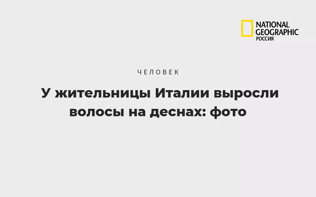 Жител на Италия е нараснал коса върху венците: снимка