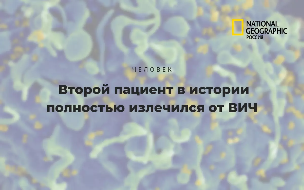 ઇતિહાસમાં બીજો દર્દી એચ.આય.વીથી સંપૂર્ણપણે ઉપચાર થયો છે