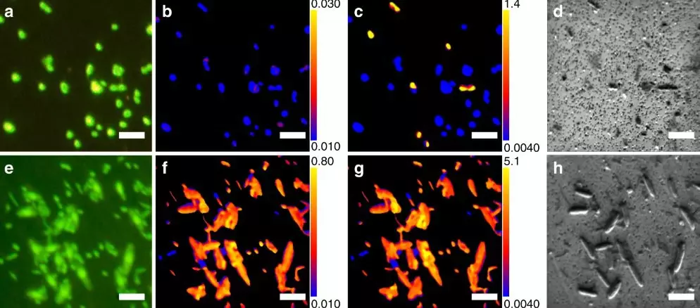 N'ala dị ala nke afọ 100 dị afọ iri abụọ achọpụtala microbes