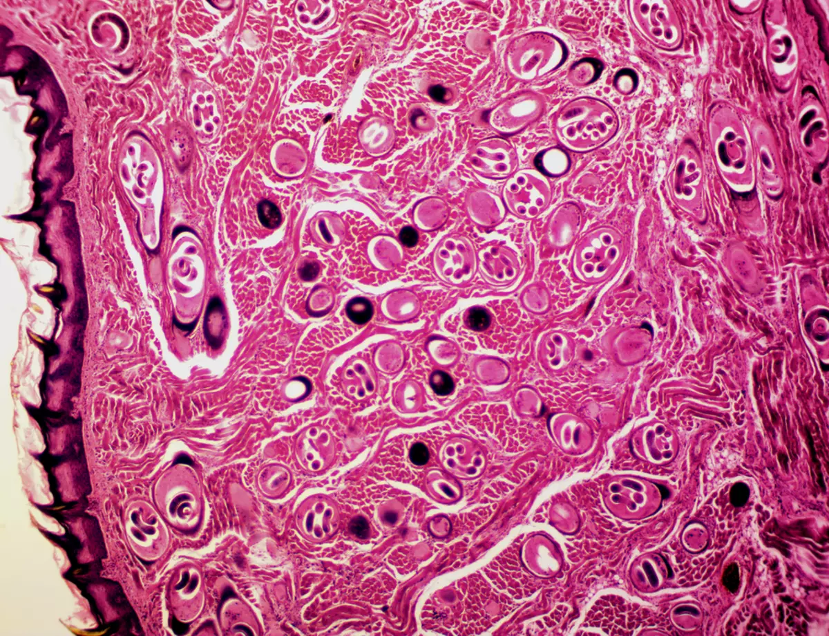 Masana ilimin halittu sun fara kamfen don adana parasites